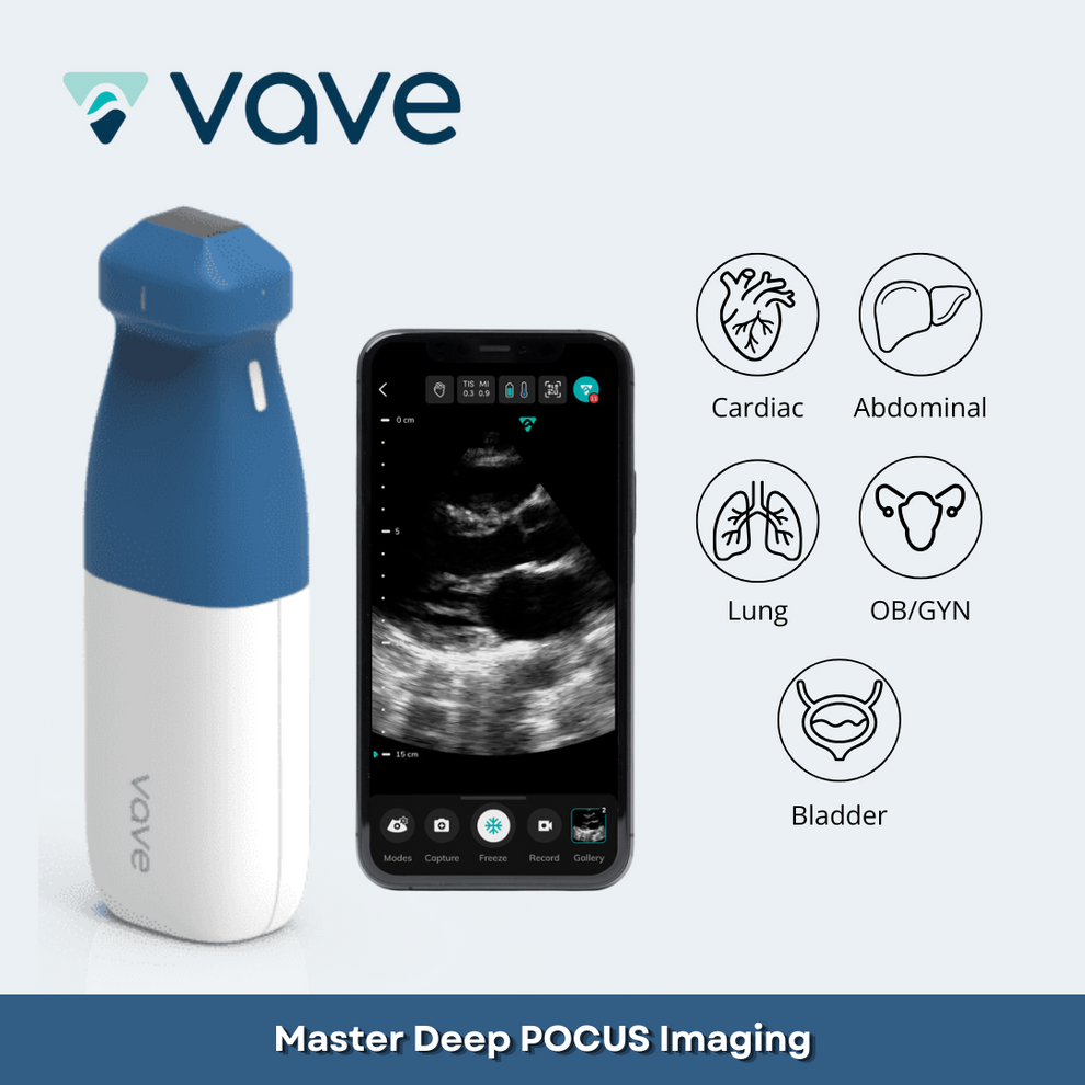 Vave Phase Probe - Wireless Ultrasound – BioD Medica